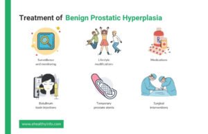 Benign Prostatic Hyperplasia (Bph): Everything You Need to Know in Malaysia