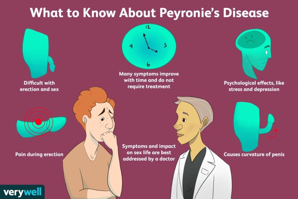 Peyronie's Disease